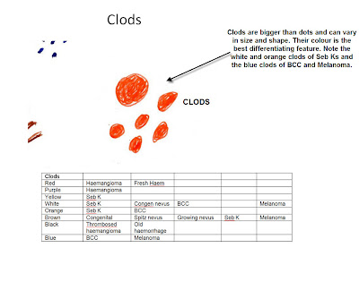 Dermoscopy Made Simple: Clods