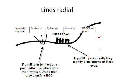 Dermoscopy Made Simple: Lines