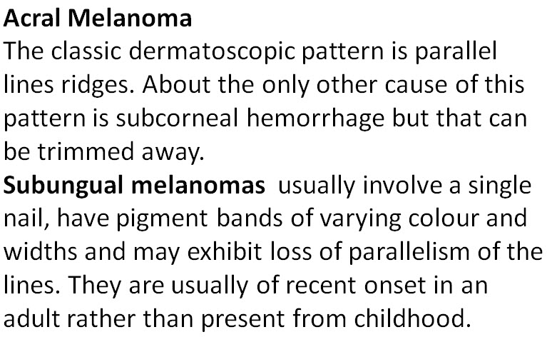 Dermoscopy Made Simple: Acral and Subungual Melanoma
