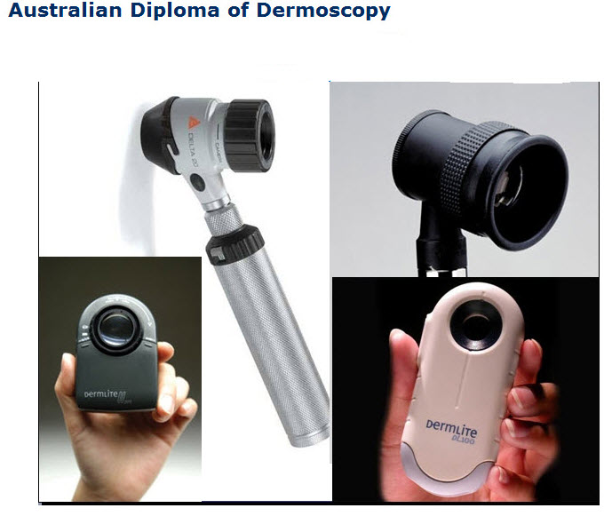 Dermatoscopy Made Simple: Dermatoscopy Diploma