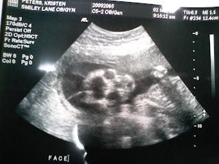 Kristen and Sean are Having a Baby: 20 Weeks!! Morphology Scan!!