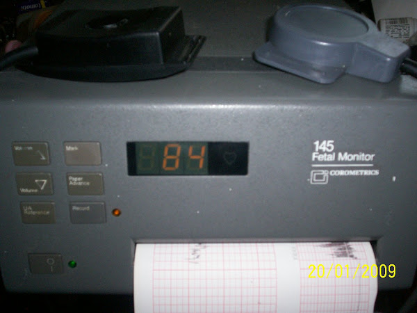 MONITOR FETAL TOCOCARDIOGRAFO: TOCOCARDIOGRAFO MONITOR FETAL