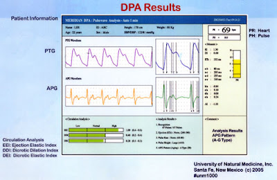 Integrative Medicine Blog: Digital Arterial Pulse-wave Analyzer
