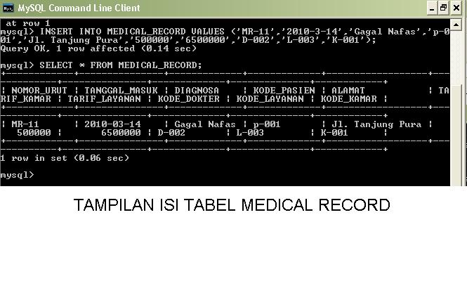 Database RUMAH SAKIT Menggunakan SQL: DATABASE RUMAH SAKIT MENGGUNAKAN MY SQL