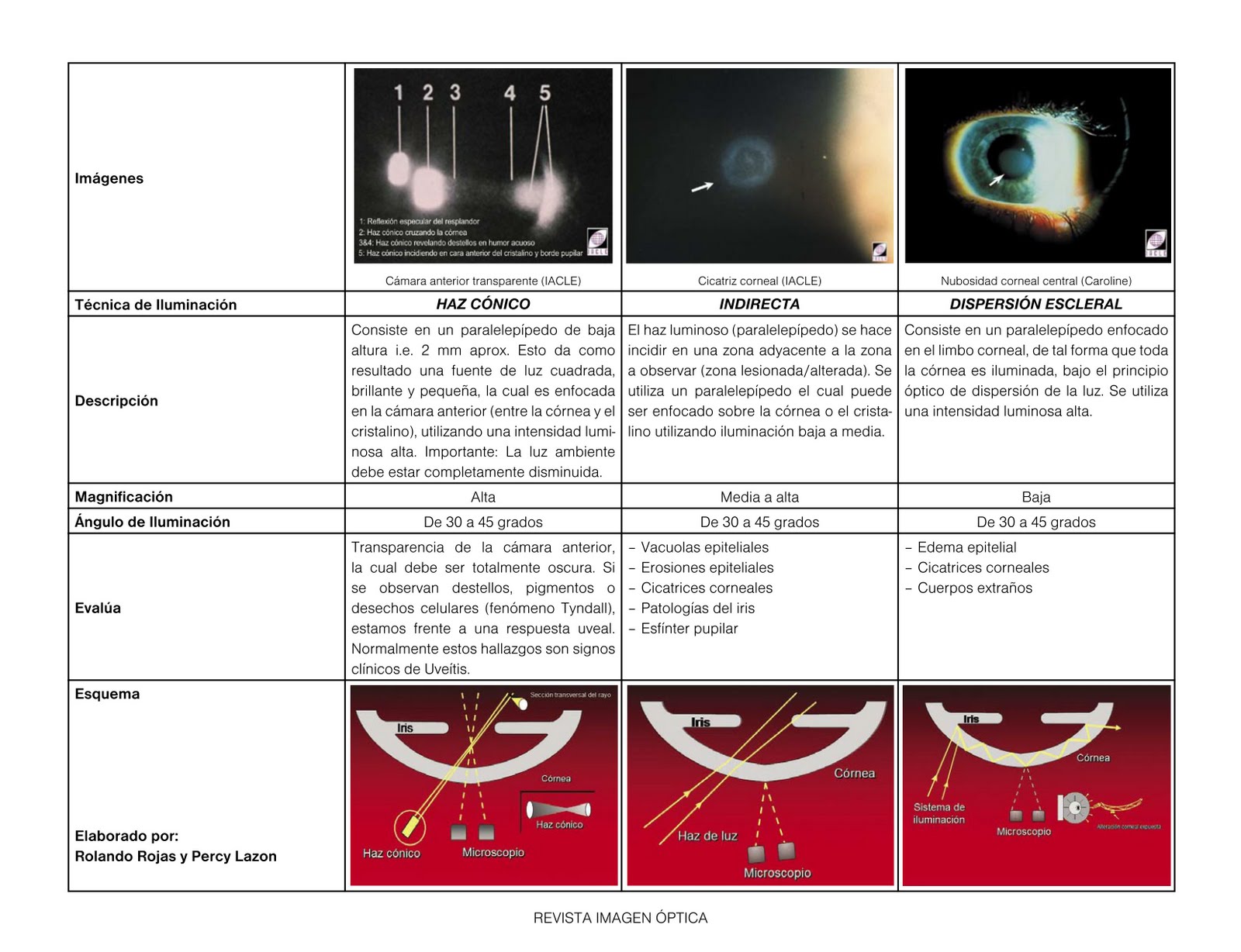 TM Oftalmología: Tabla de Biomicroscopía
