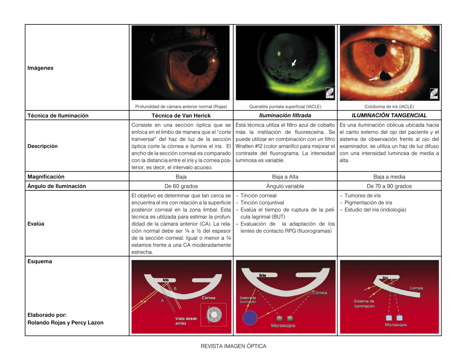 TM Oftalmología: Tabla de Biomicroscopía