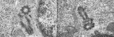 Rothbot's Microscopy: Centrioles!