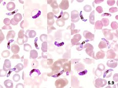 Parasitologia: Esporozoários - Filo Apicomplexa