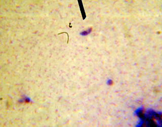 Parasitologia: Esporozoários - Filo Apicomplexa