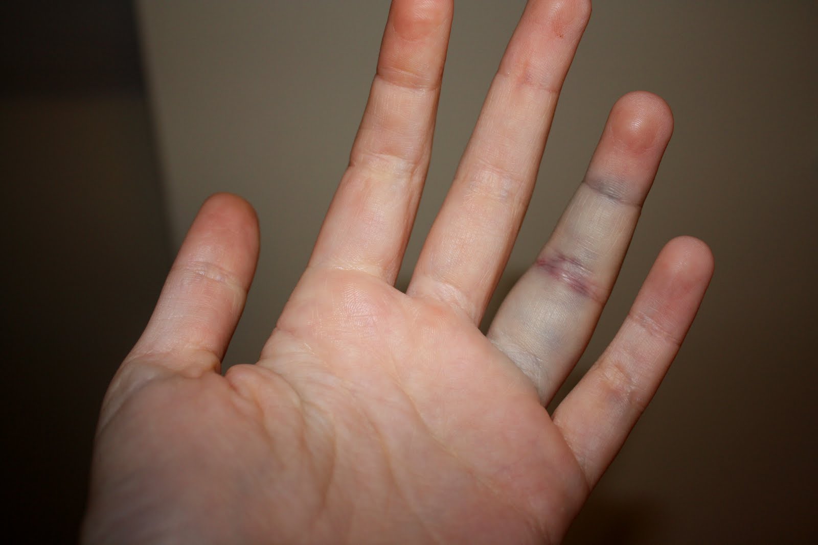 zombie finger | red, white, but not blue