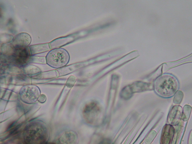 SUKA LABOR BLOGS: Thielaviopsis sp