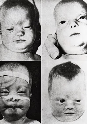 .: Dismorfismo Facial