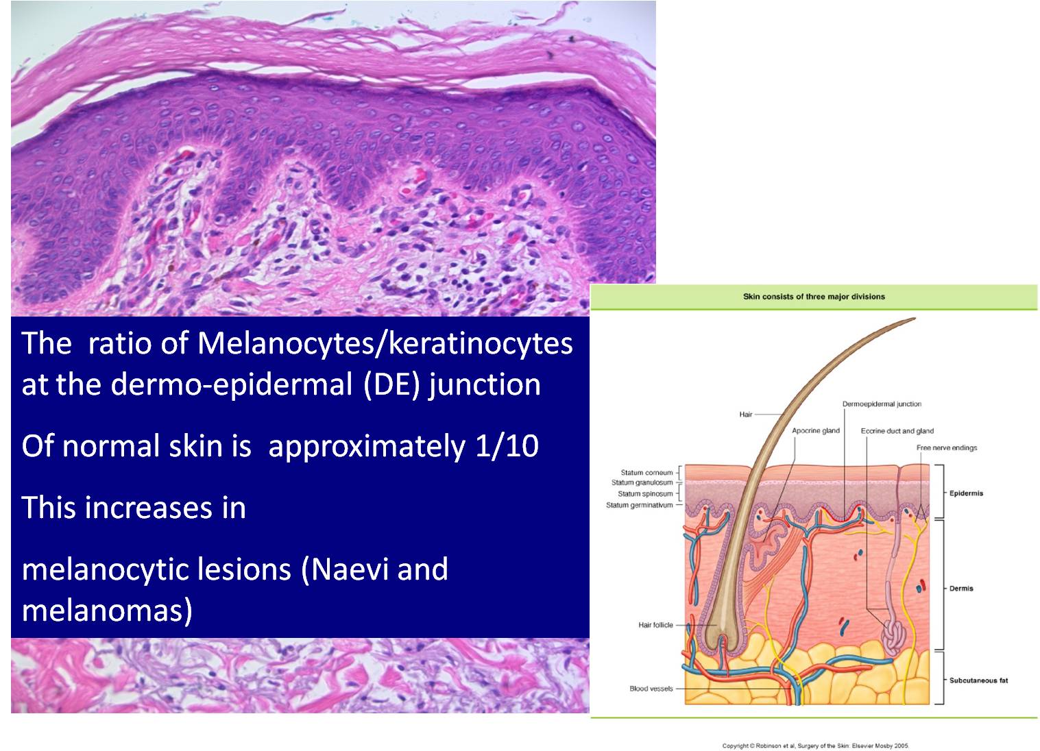 Introduction to Dermatoscopy