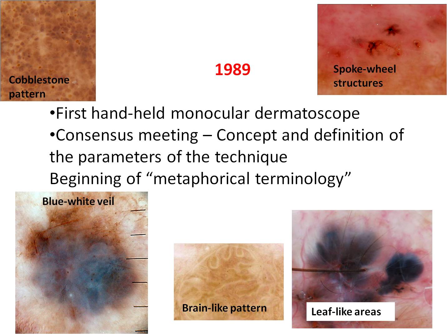 Introduction to Dermatoscopy