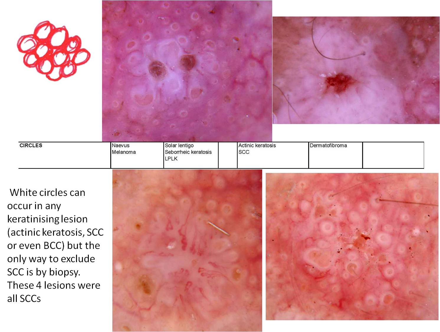 Introduction to Dermatoscopy