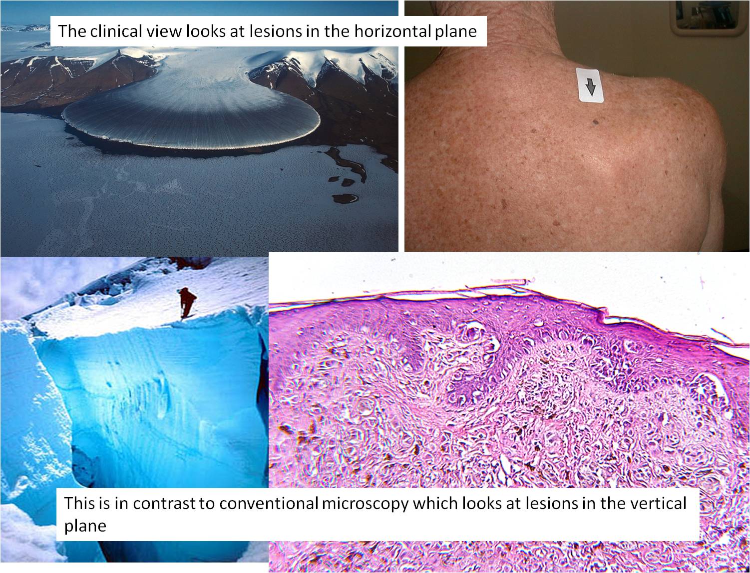 Introduction to Dermatoscopy