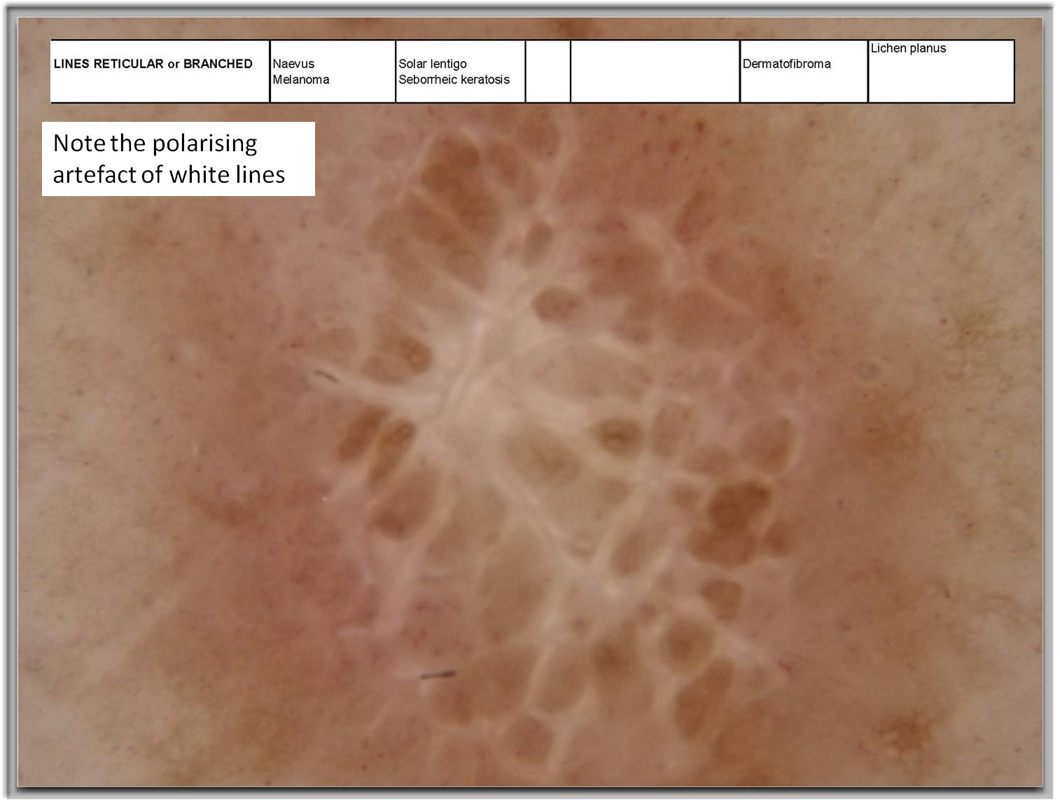 Introduction to Dermatoscopy