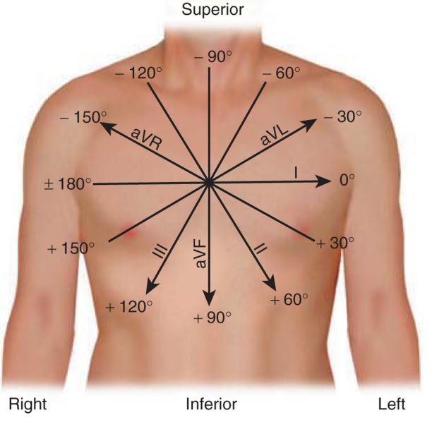 Blog do ECG: EIXO HEXAXIAL DE BAYLEY