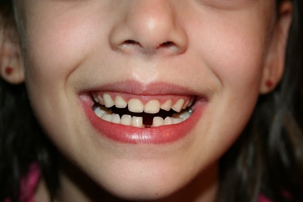 Grace Upon Grace: Toothless Wonder