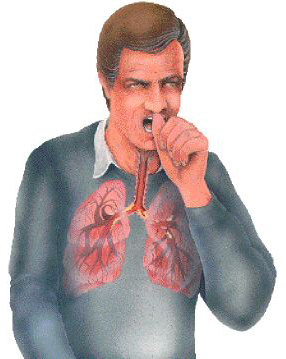 Recomendaciones para tos | Remedios Caseros - Remedios Naturales ...