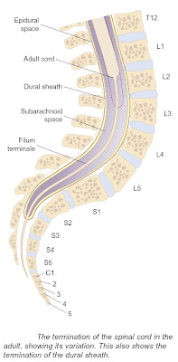 CHIARI SIRINGOMIELIA SEZIONE DEL FILUM