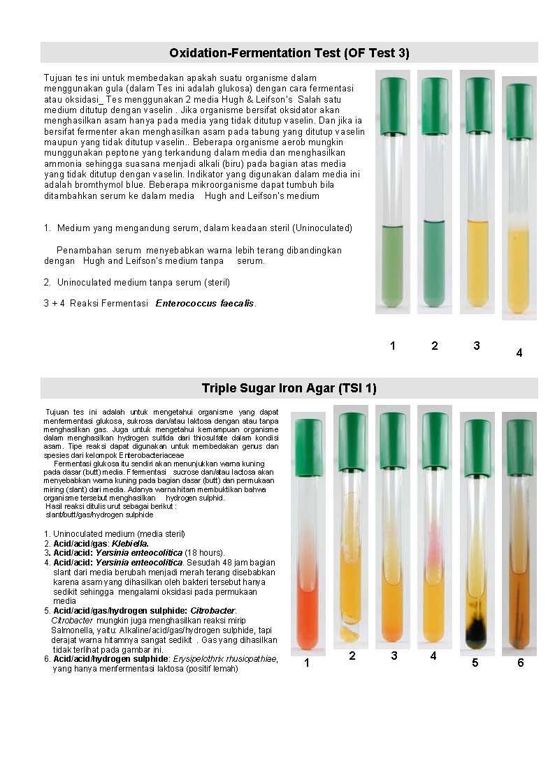 MIKROBIOLOGI UNTUK TEHNISI KESEHATAN: UJI BIOKIMIA