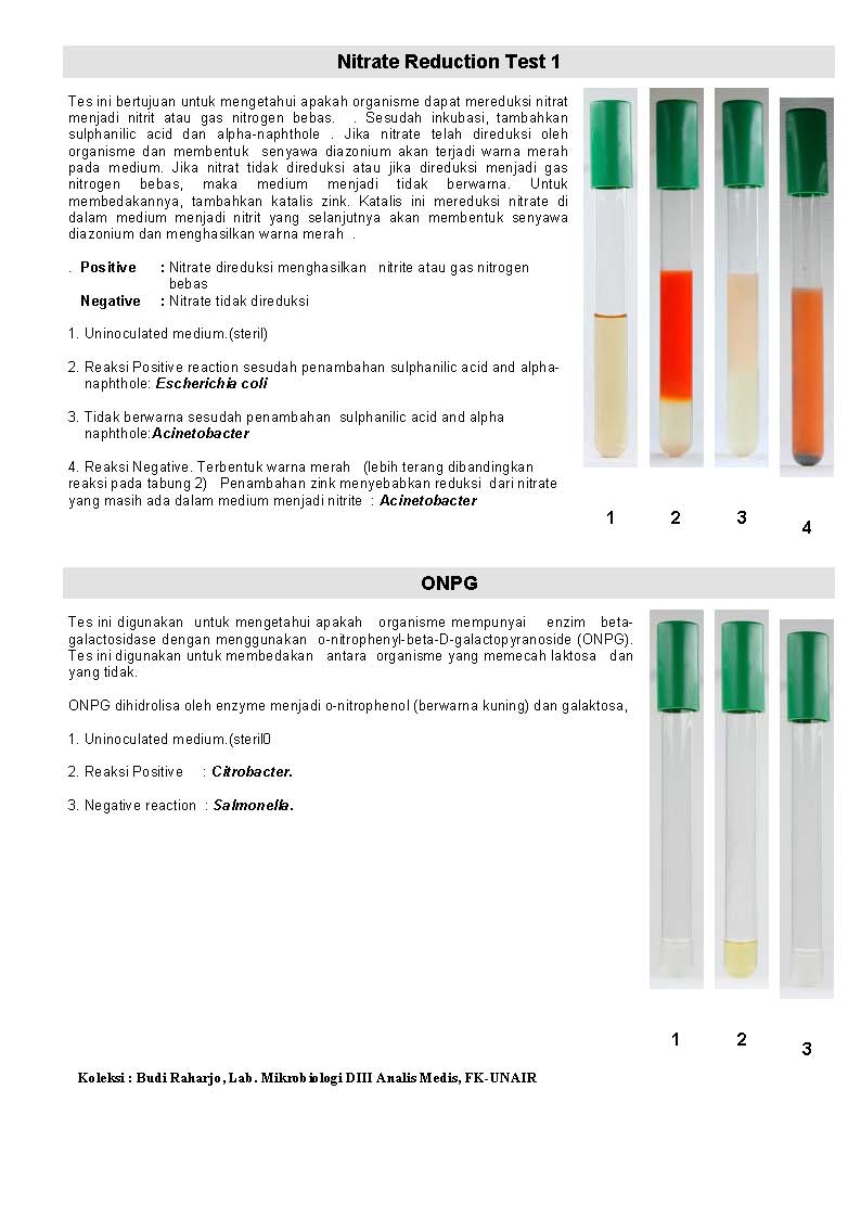 MIKROBIOLOGI UNTUK TEHNISI KESEHATAN: UJI BIOKIMIA