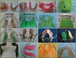 OFM - Ortopedia Funcional dos Maxilares: Onde Fica