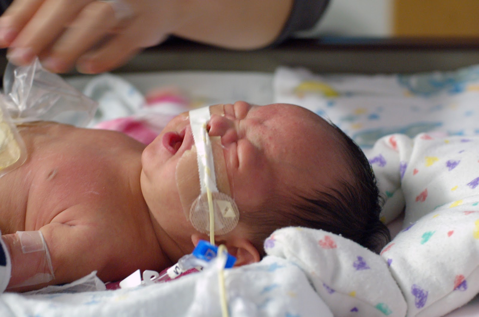 We Love Chloe: Sun, Nov.28 TPN dressing change.