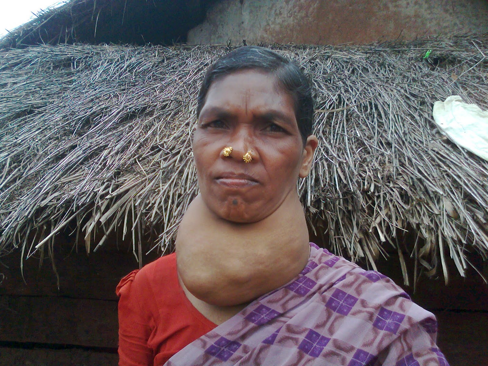 Machkund Vartalu Tribal Women Need Help