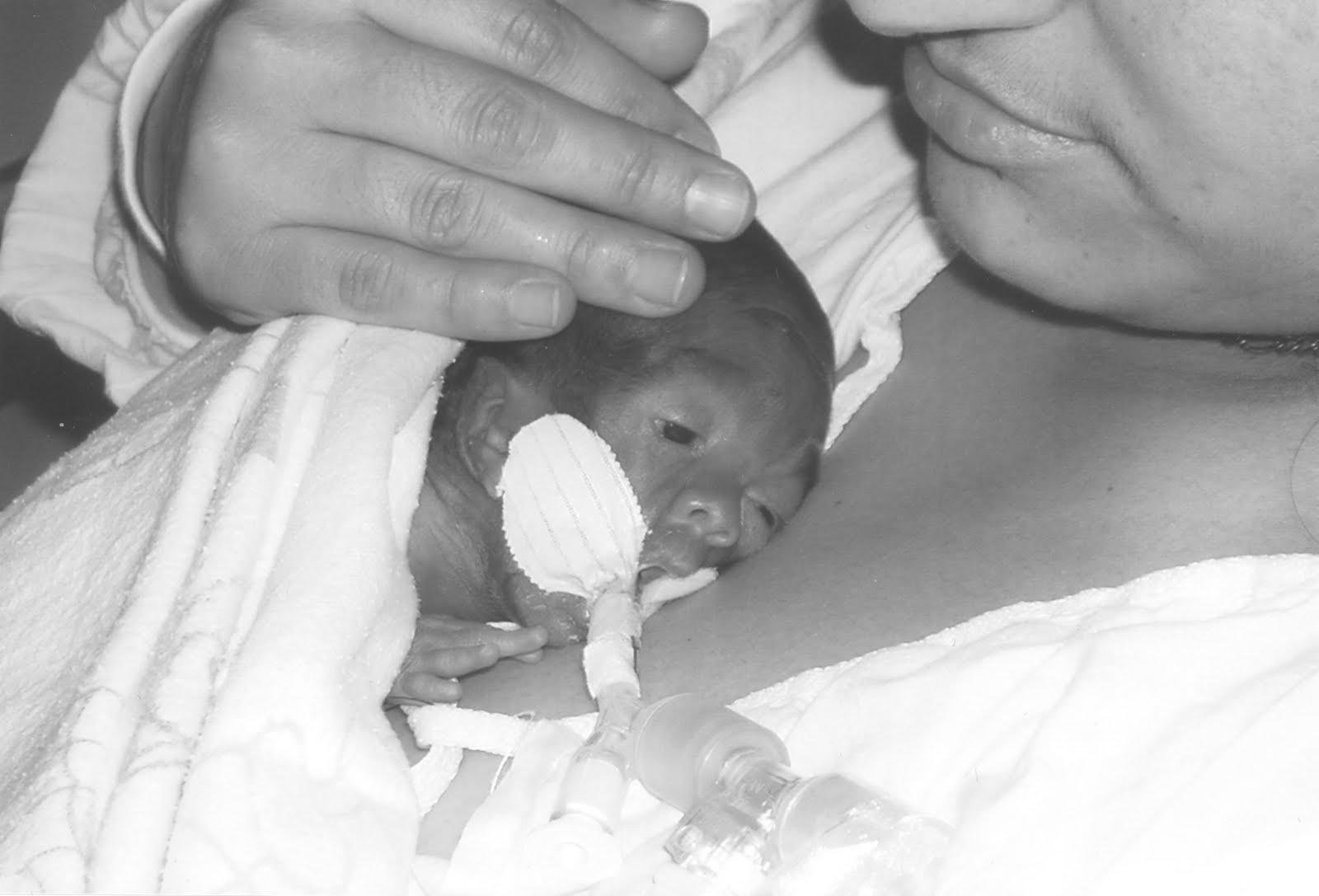 MCCL Blog: Aborted baby left to die, survives for two days