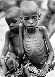 Nutrição/DistúrbiosAlimentares12i: Desnutrição