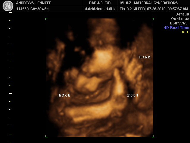 Sweet Caroline: 31 Weeks and 3D Ultrasound!!