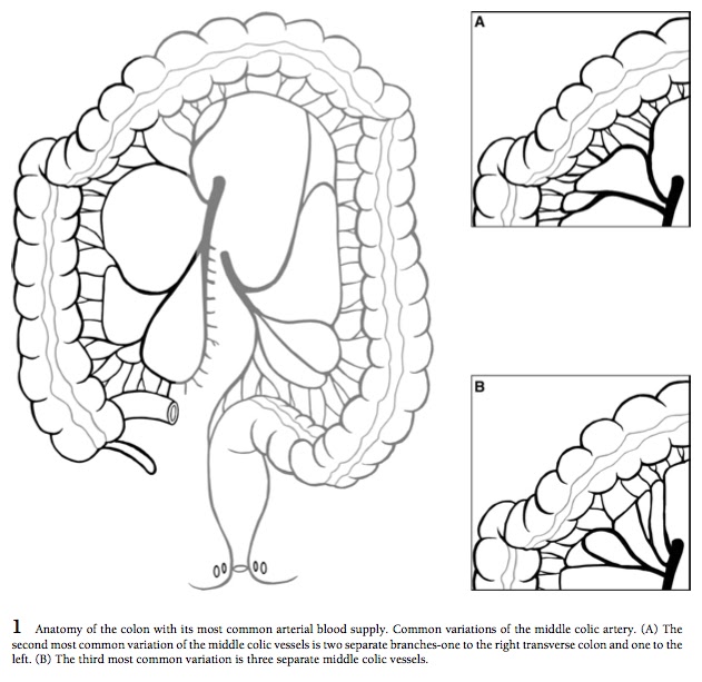 surgical operations: Open Right Hemicolectomy