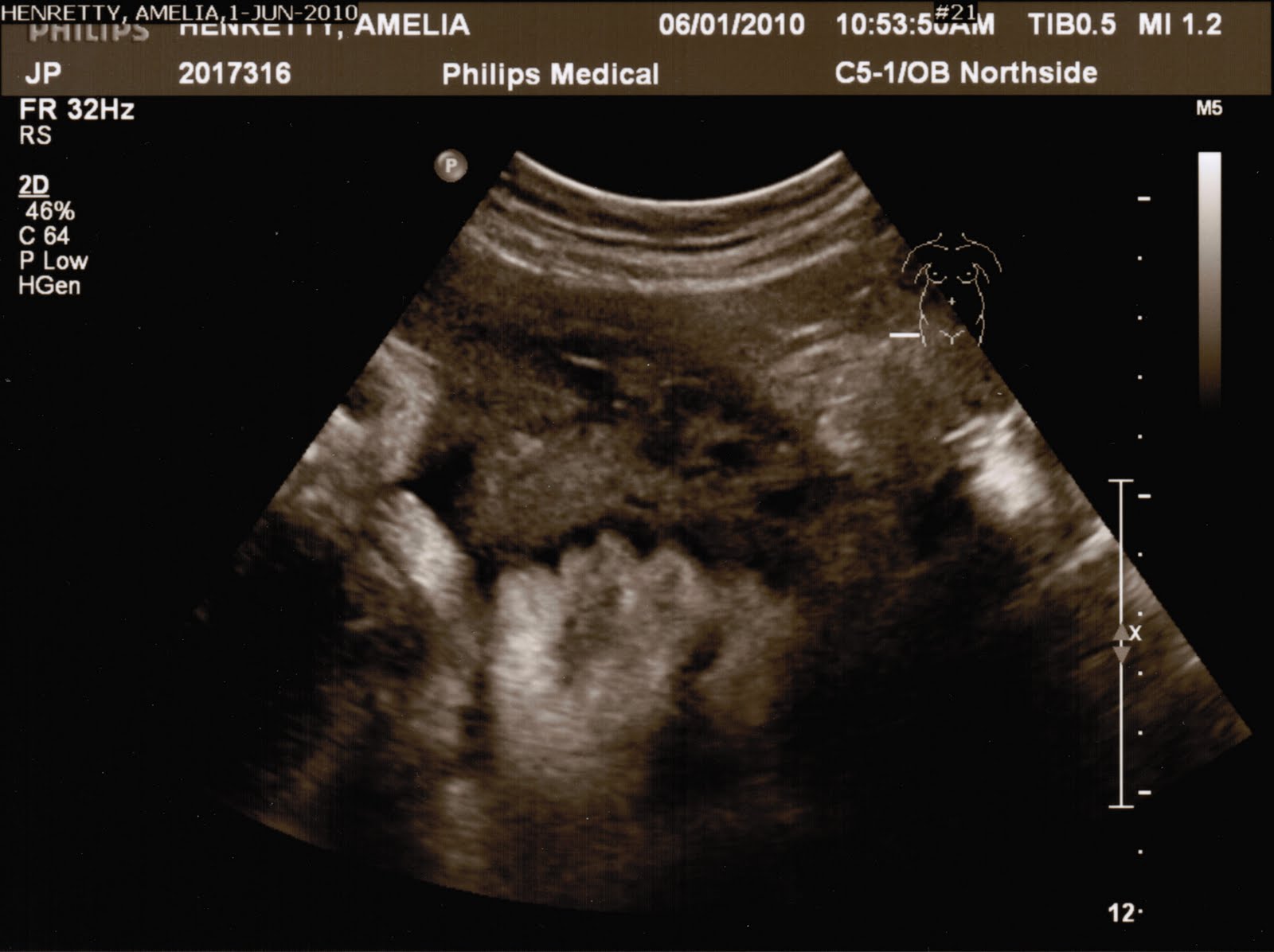 Henretty Happenings: Ultrasound pictures - 31 weeks