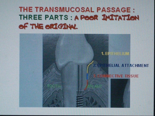 THE TRANSMUCOSAL PASSAGE OF THE DENTAL IMPLANT AND THE THREE CRITICAL ...
