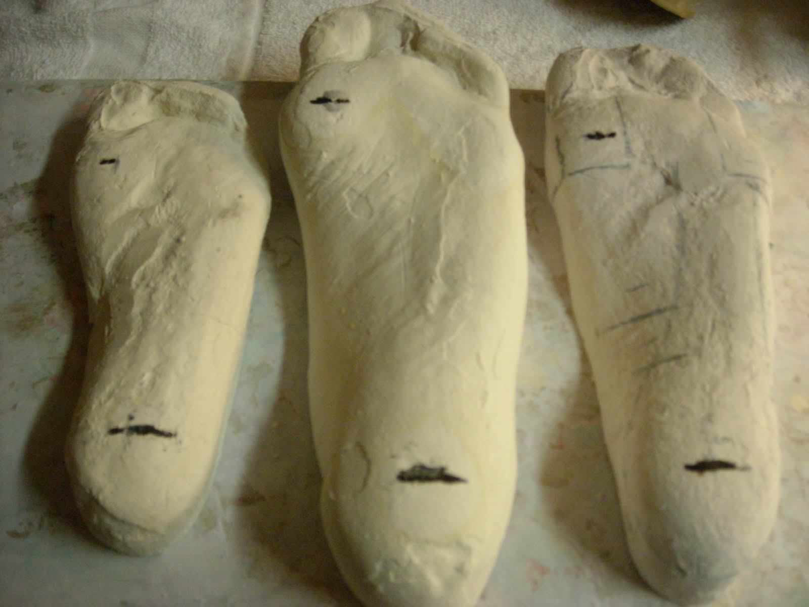 Foot and Ankle Problems By Dr. Richard Blake: Inverted Orthotic ...