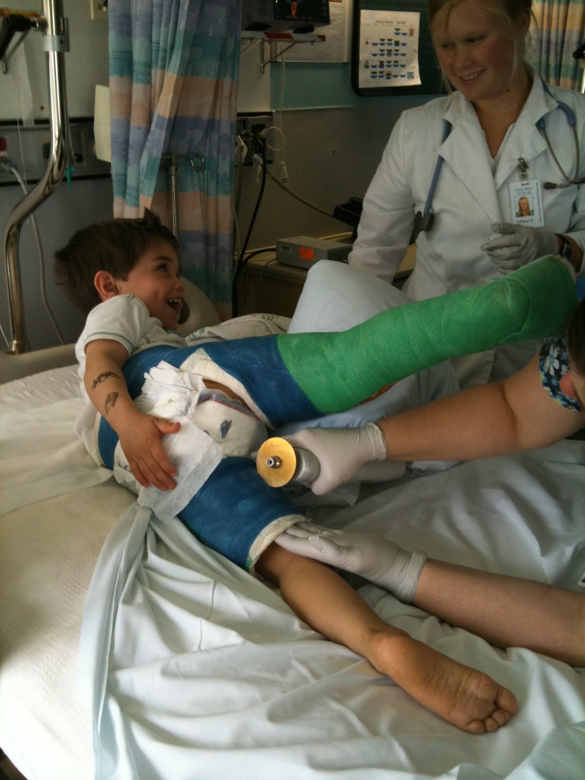 A Child's Journey with Perthes Disease: The Cast is OFF!