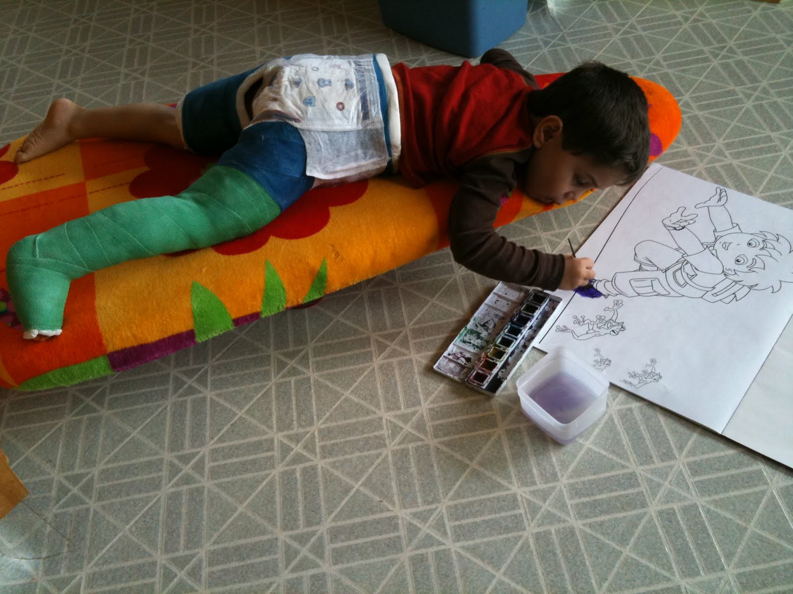 A Child's Journey with Perthes Disease: The Cast is OFF!