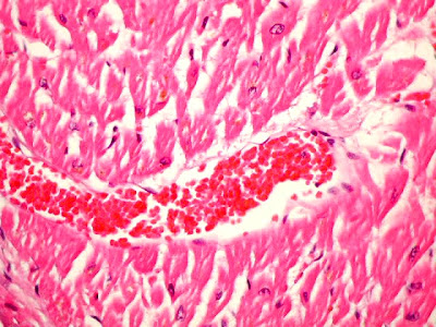 HISTOLOGIA DEL APARATO CARDIORESPIRATORIO: El corazón