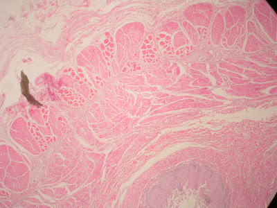 Histologia Digestivo II: Esófago