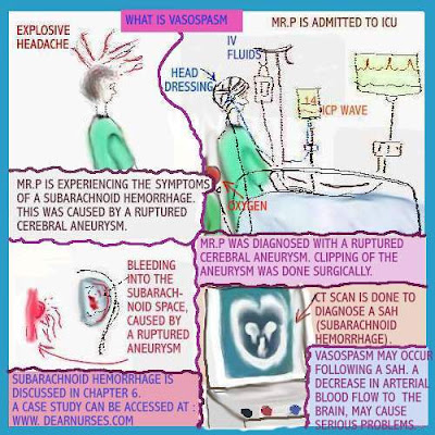 Dear Nurses: VASOSPASM AFTER SUBARACHNOID HEMORRHAGE