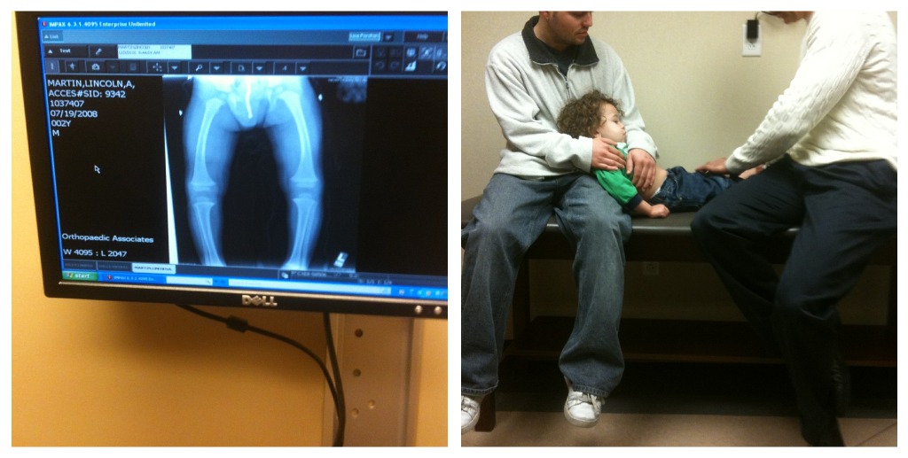 Stoic Tia: My bowlegged baby...