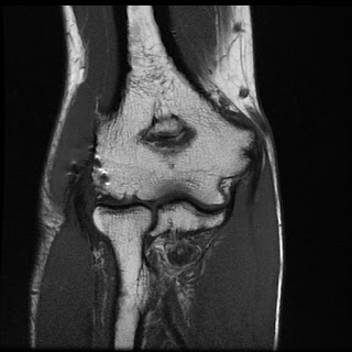 Radiology Cases: September 2008