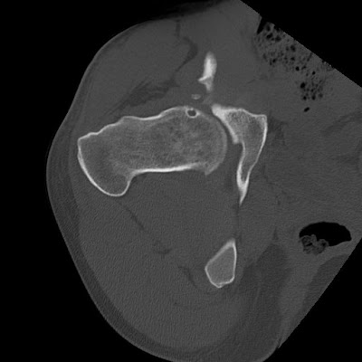 Radiology Cases: December 2008