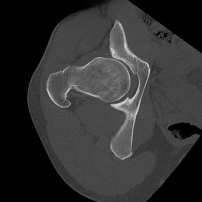 Radiology Cases: December 2008