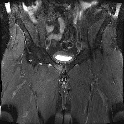 Radiology Cases: January 2009