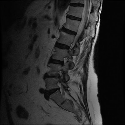 Radiology Cases: March 2009