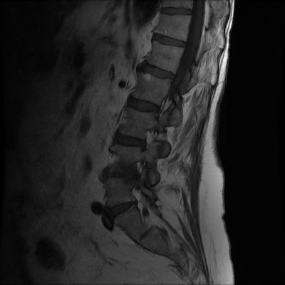 Radiology Cases: March 2009