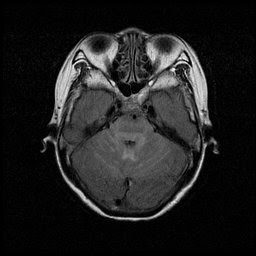 Radiology Cases: March 2009